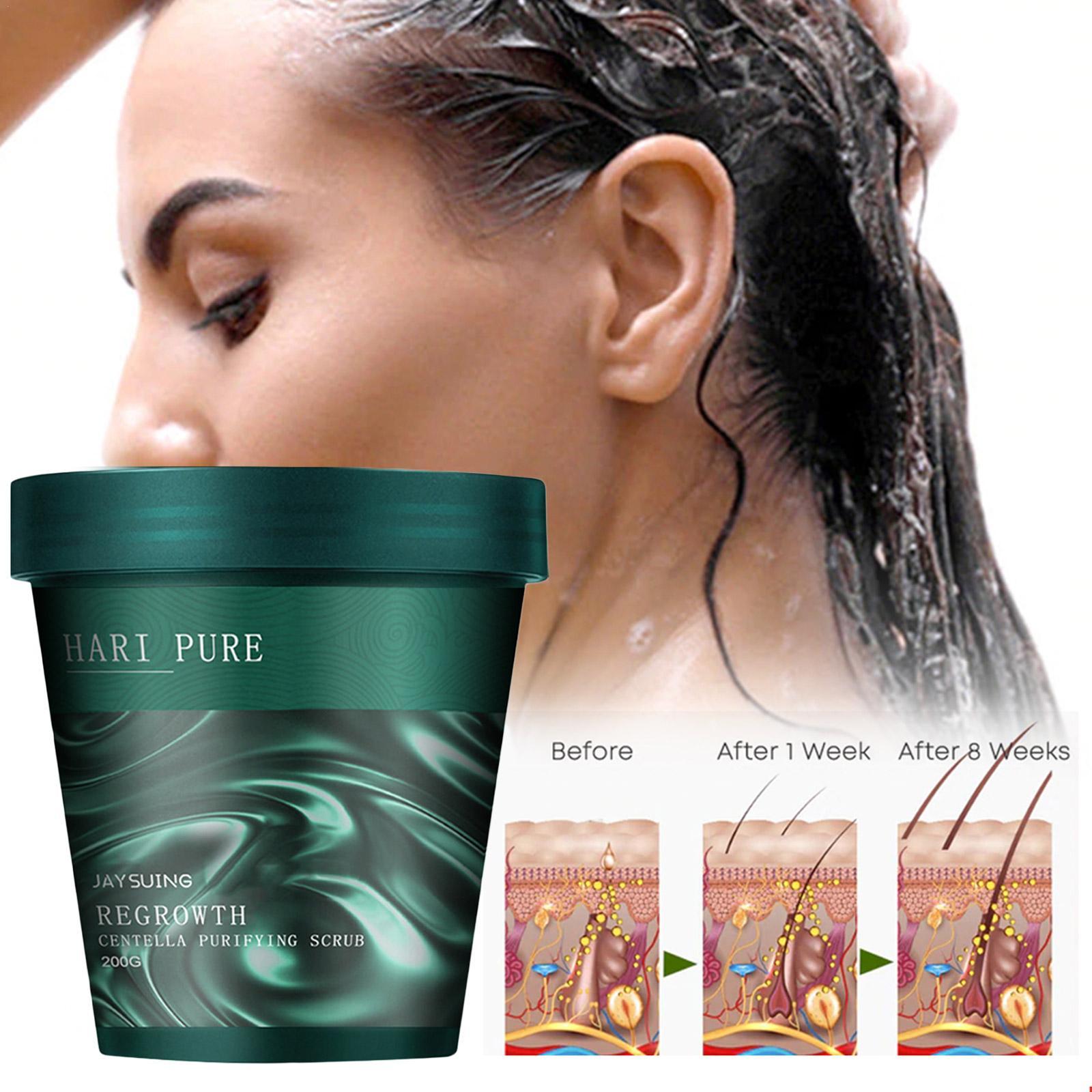 Beauty ReGrowth Centella Ginger Salt Anti-dandruff Shampoo – Alert Trendy